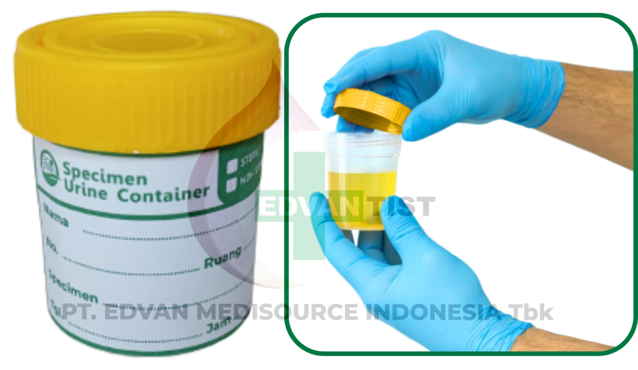 Ecogreen Urine Container 60mL – PT. Edvan Medisource Indonesia